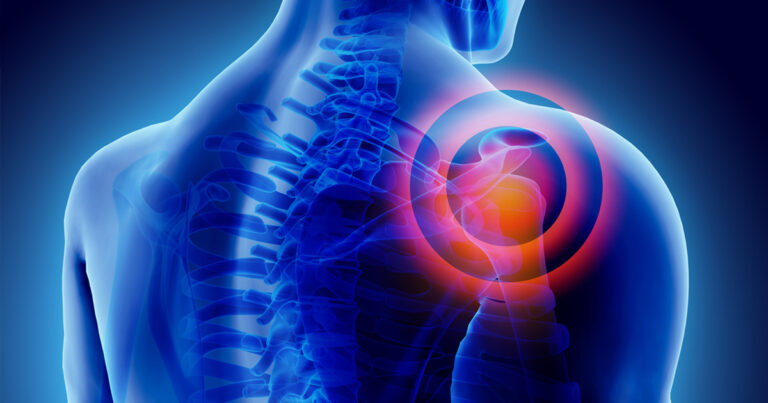 Best water exercises to improve shoulder health